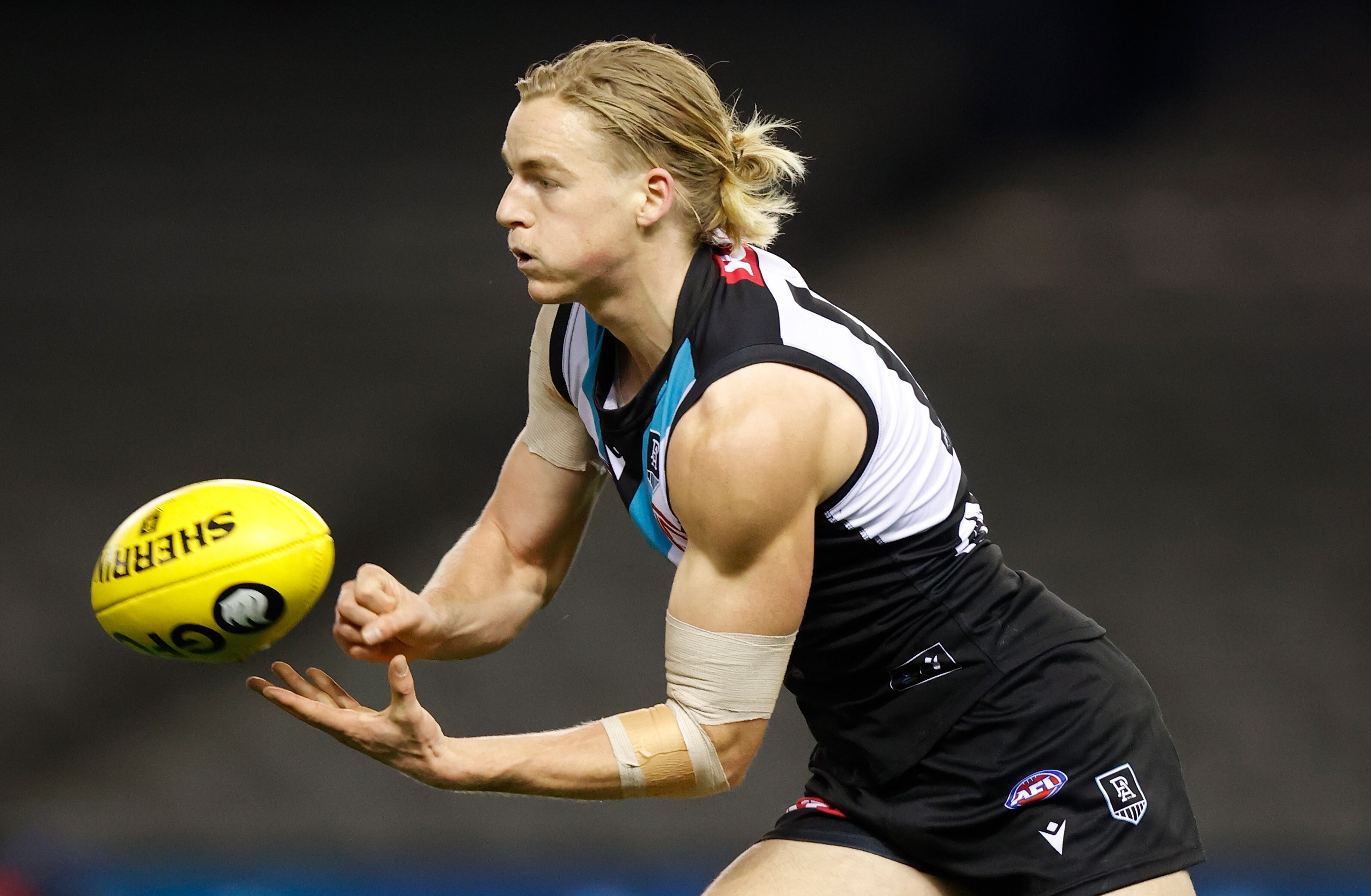 Bergman undergoes shoulder procedure