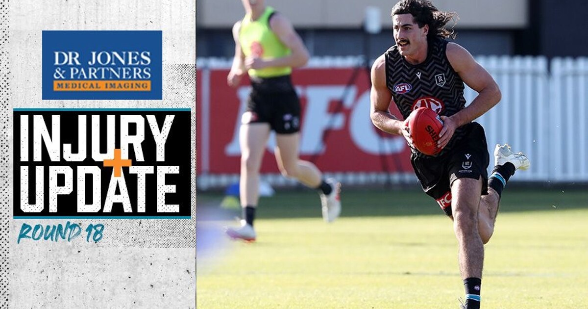 Injury update: Jones available for selection
